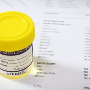 Underactive Bladder Causes, Symptoms, Diagnosis and Treatment