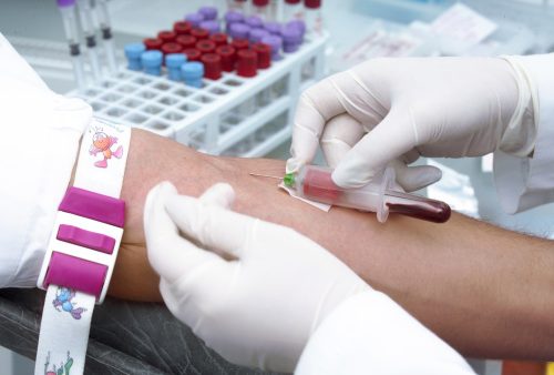 New tuberculosis test helps improve diagnosis