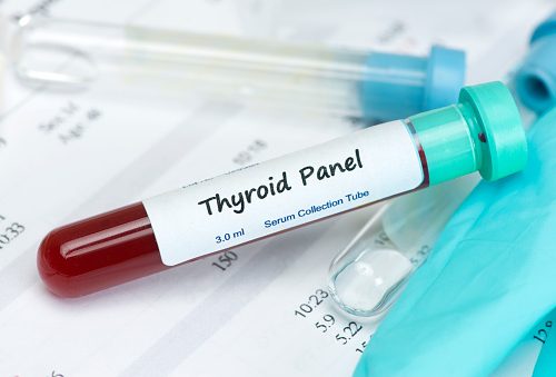 Hypothyroidism (underactive thyroid gland) treatment guidelines updated ...