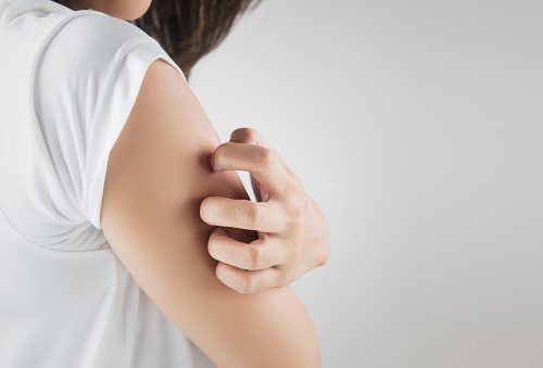 Key multiple sclerosis itching symptom (pruritus) can cause burning pain