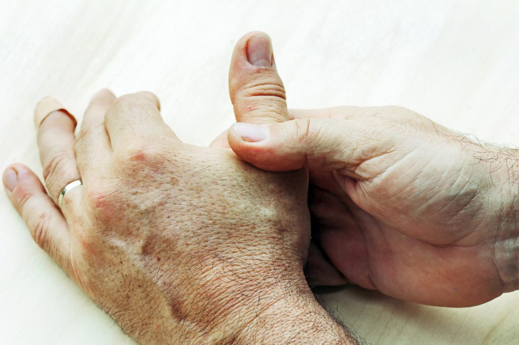 Rheumatoid arthritis vs. osteoarthritis, differences in symptoms ...