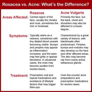 Lupus vs. rosacea, differences in symptoms, causes, and treatment