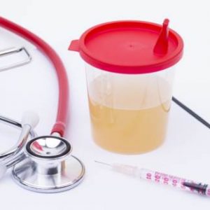Mucus in Urine: Types, Common Causes & Treatment Options