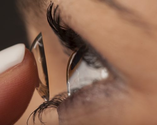 Eye damage can occur with improper use of contact lenses: CDC