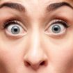 Bulging Eyes: Causes,Exercises and Safety Tips