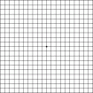 Amsler Grid Test: Detecting Macular Degeneration & Other Eye Diseases