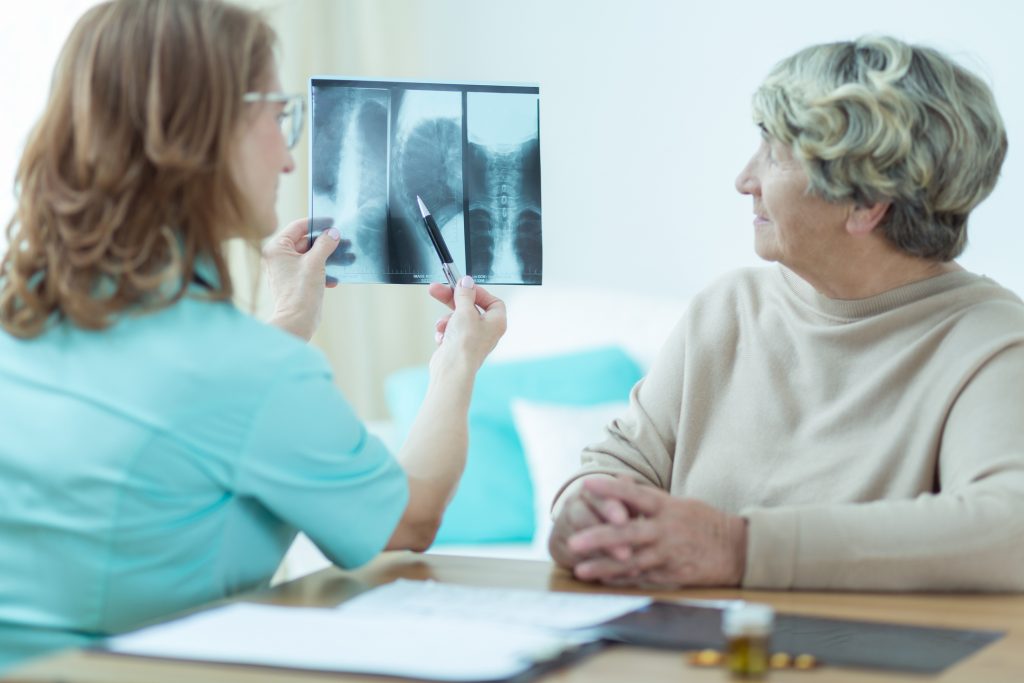 Osteopenia, decreased bone density: Causes, risk factors, and diagnosis