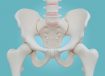 Sacroiliitis: Causes, Symptoms, Treatment and Exercise Tips