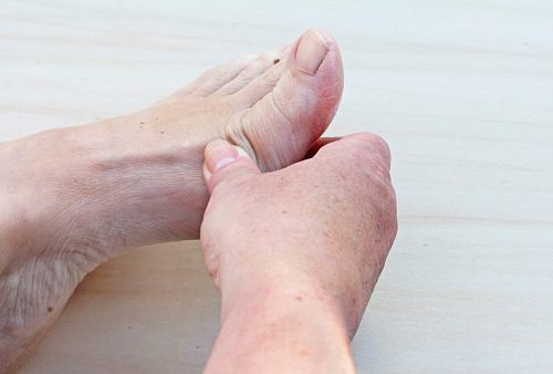 Rheumatoid arthritis and feet: The connection and feet arthritis pain ...
