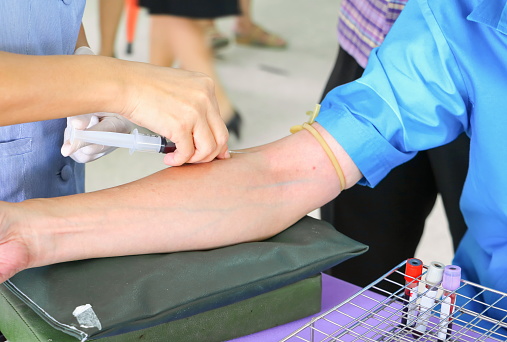 Collapsed veins: Causes, symptoms, and treatment