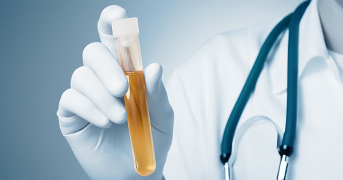 Crystals in urine: Know the causes and treatment