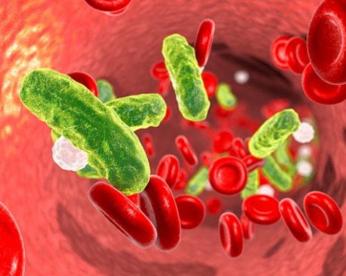 Urosepsis in elderly: Causes, symptoms, and treatment