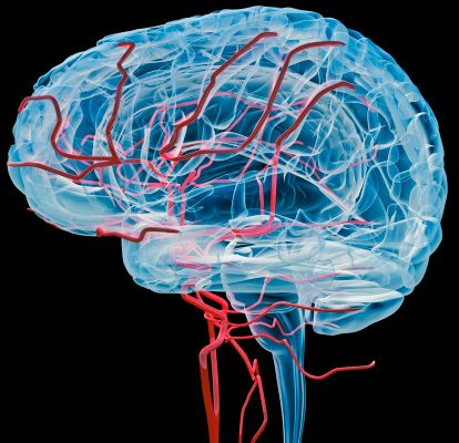 Small vessel disease of the brain linked to memory loss