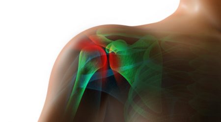 Shoulder crepitus: Causes, symptoms, and exercises