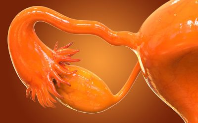 What is an enlarged ovary? Causes, symptoms, and treatment
