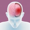 Cerebral (brain) atrophy: Why your brain is shrinking and what to do ...