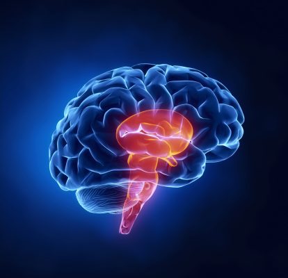 Brain Stem Stroke: Causes, Symptoms, and Treatment
