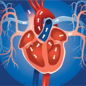 Enlarged heart update: Mild cardiomegaly, left & right atrial ...