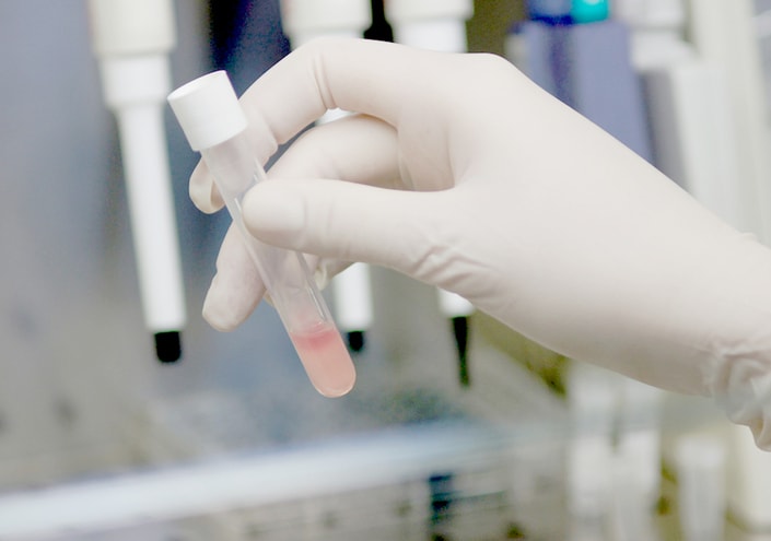 Blood in Stool May Be a Sign of Colon Cancer