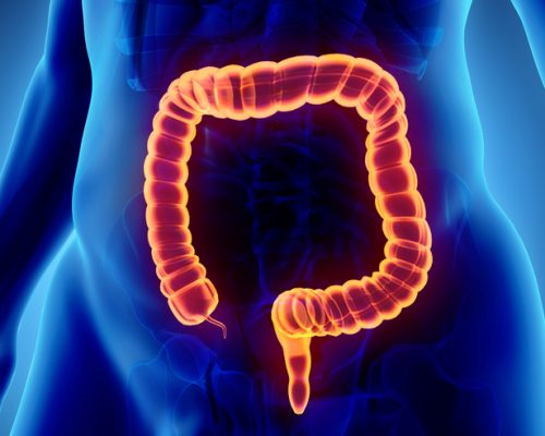 Microscopic Colitis: Types, Causes, Symptoms, and Diet