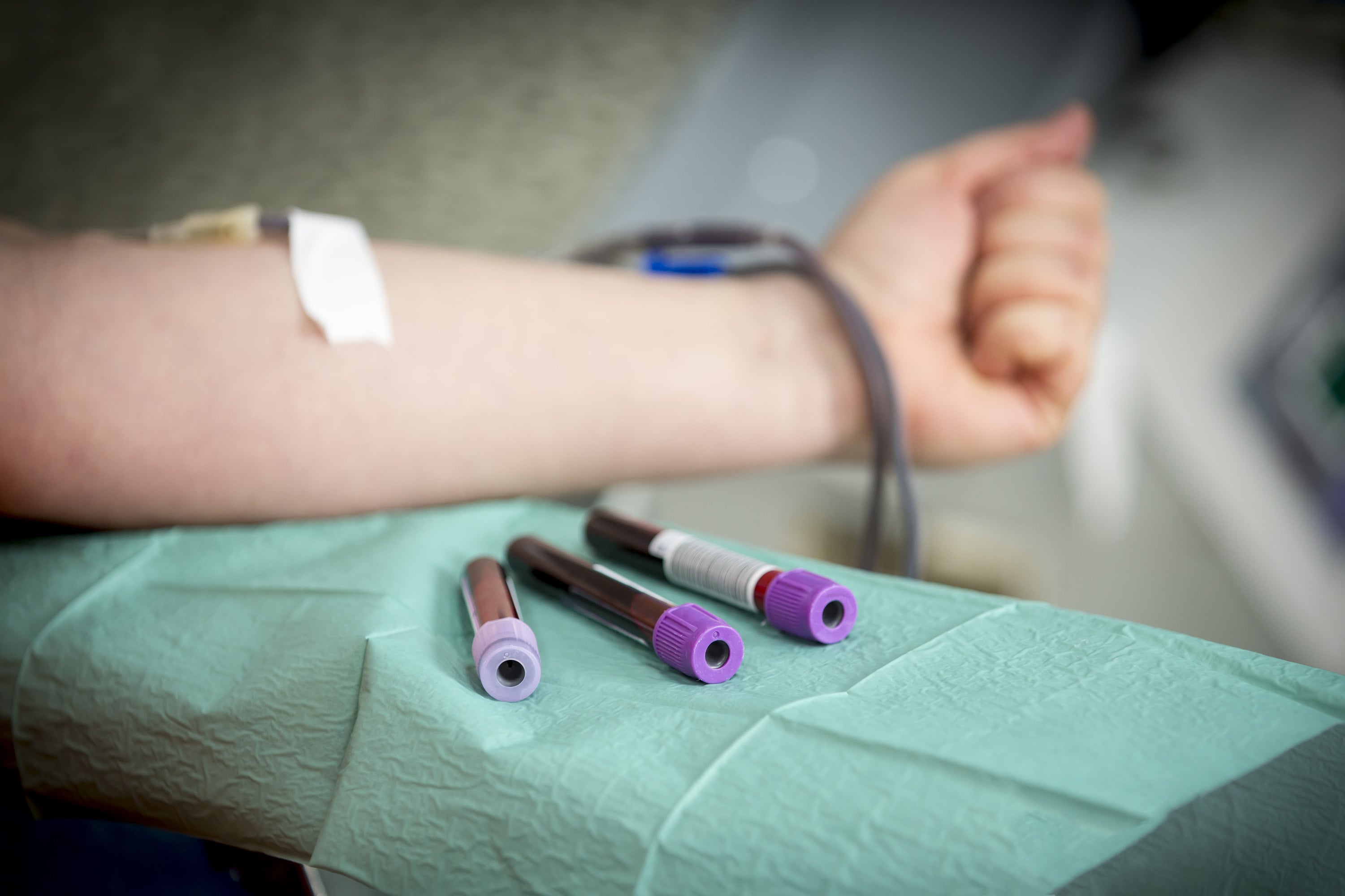 Blood Test May Predict Stroke Risk In Diabetic Patients