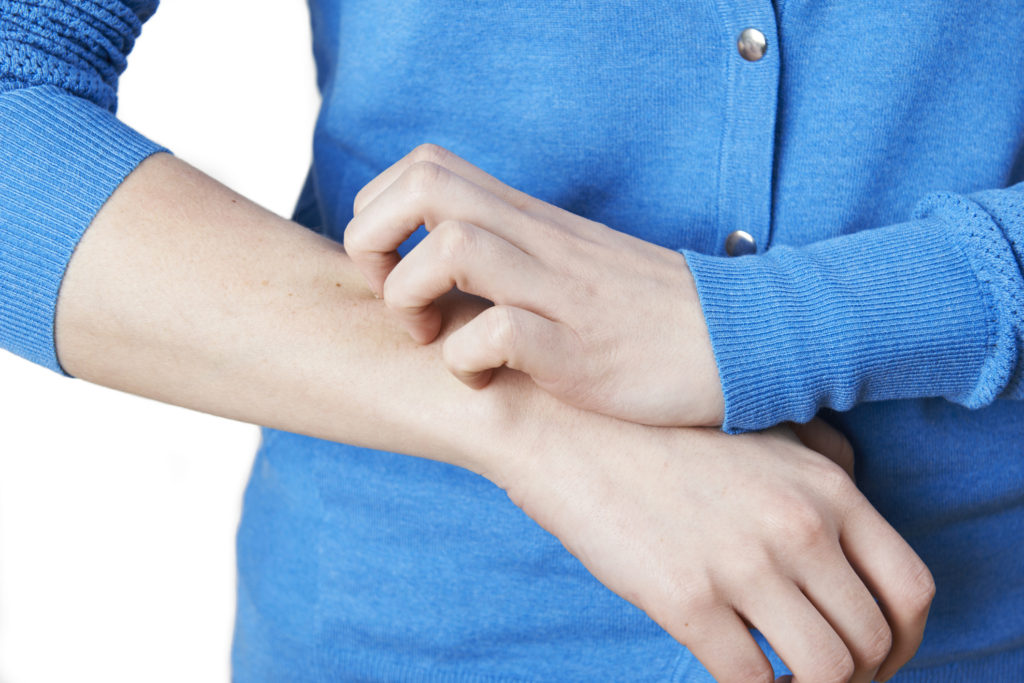 Shingles and Stroke Risk