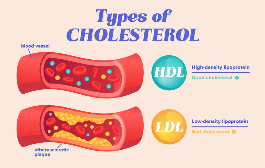 A Few Things You Need To Know About Cholesterol A Few Things You Need To Know About Cholesterol