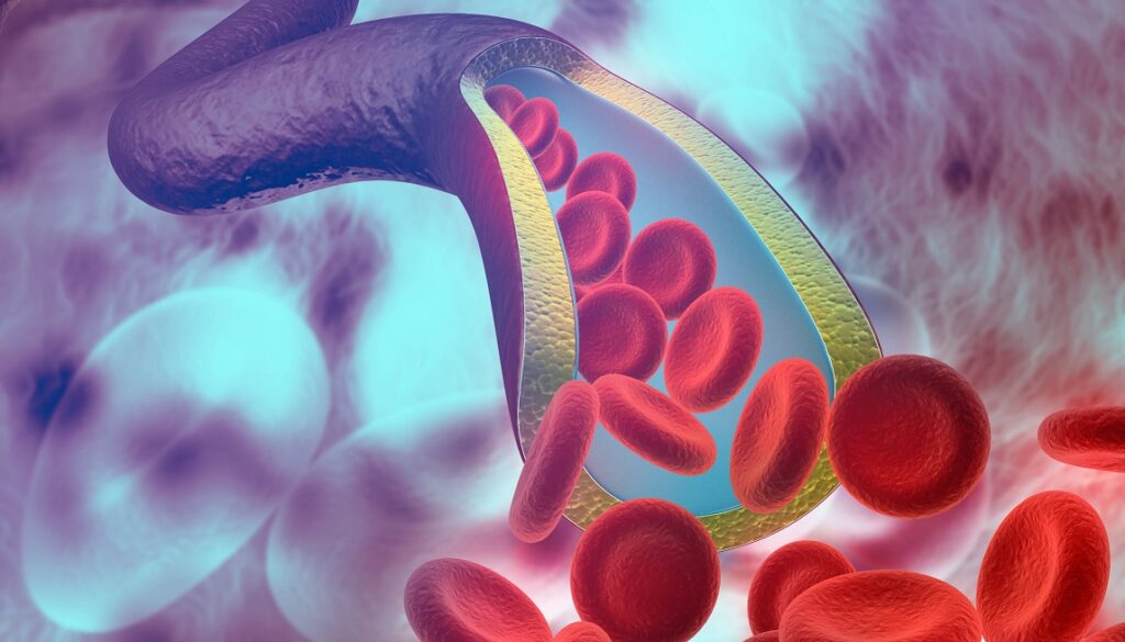 Healthy Artery Action Plan